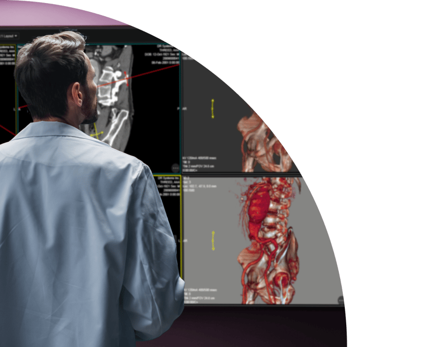 Merge Universal Viewer