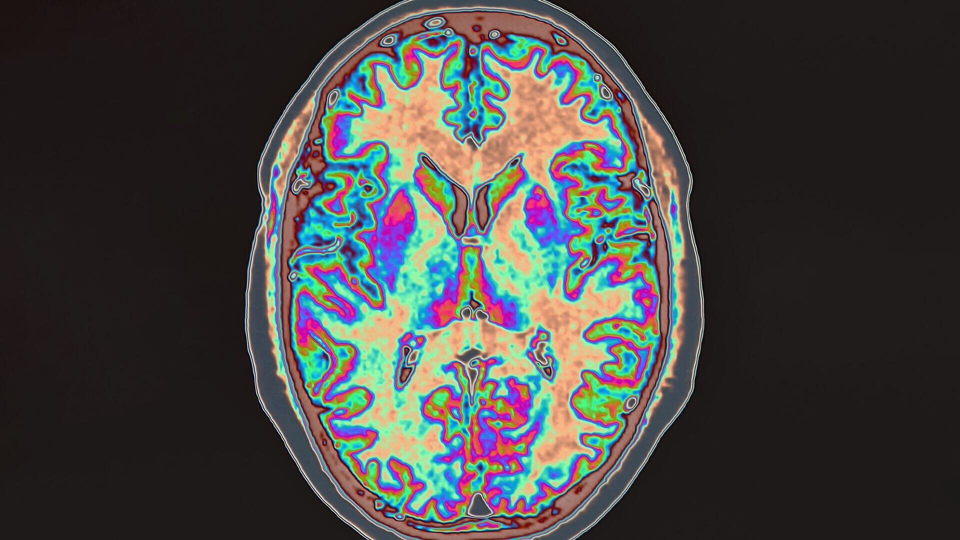 Medical Imaging Solutions and Software | Merative