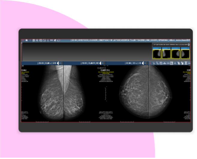 Radiology solutions | Merative