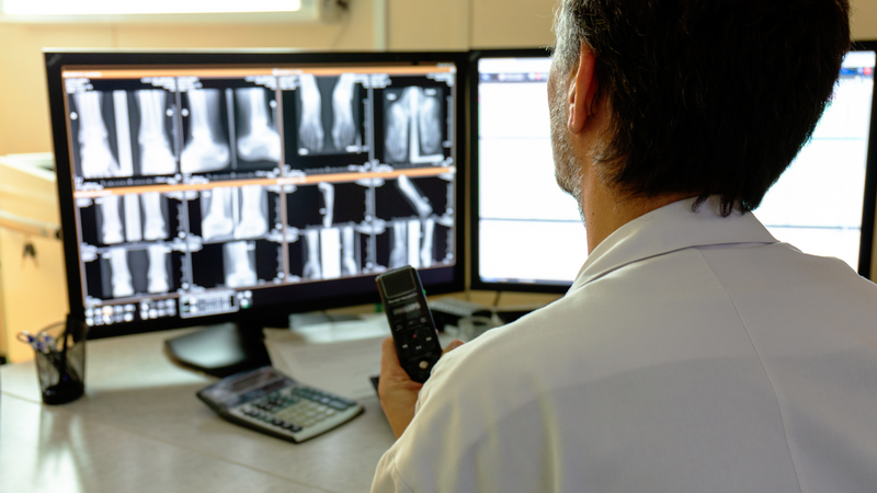 Merge Vendor Neutral Archive