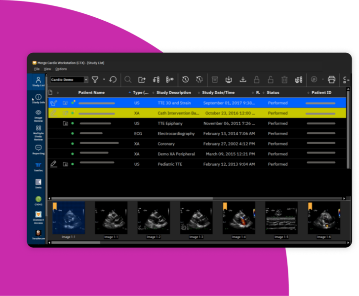 Cardiovascular Information System (CVIS) | Merative