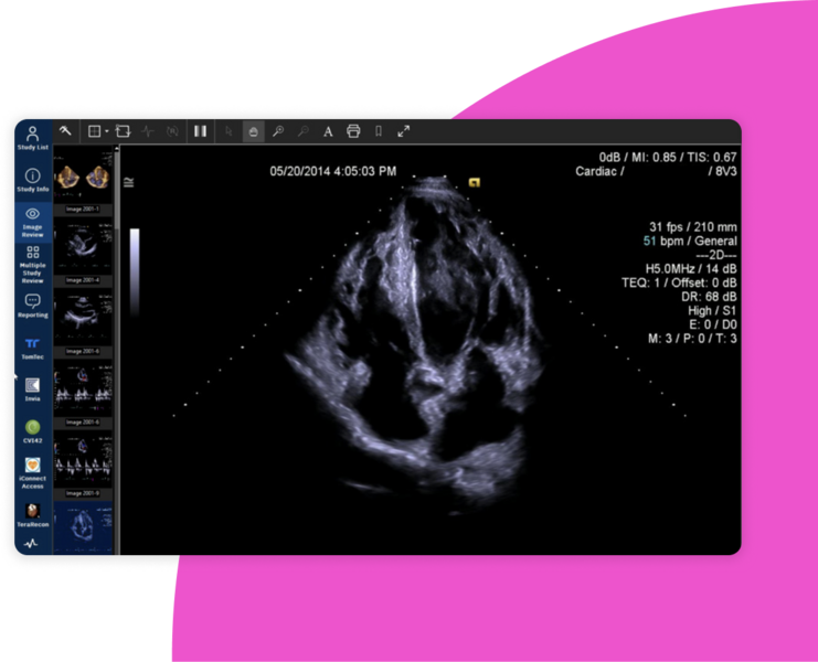 Cardiovascular Information System (CVIS) | Merative