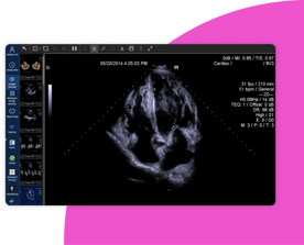 Cardiovascular Information System (CVIS) | Merative