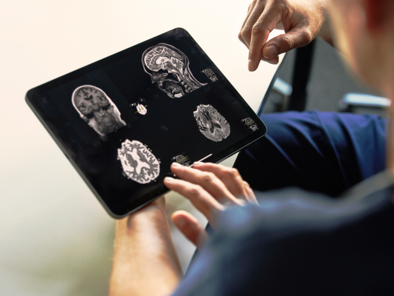 Workflow orchestration to streamline radiology | Merge by Merative