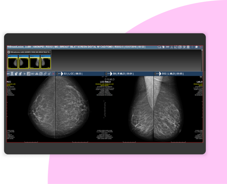 Enterprise PACS System| Merative