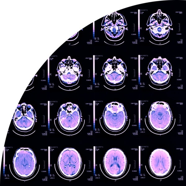 Enterprise PACS System| Merative