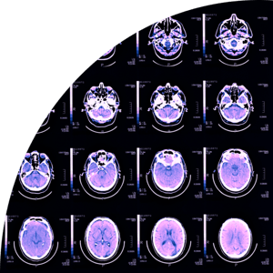 Enterprise PACS System| Merative