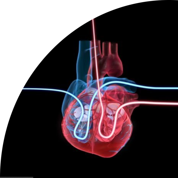 Hemodynamic Solution | Merative