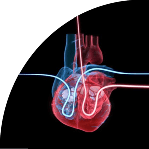 Hemodynamic Solution | Merative