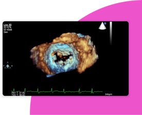 Cardiology Solutions | Merative