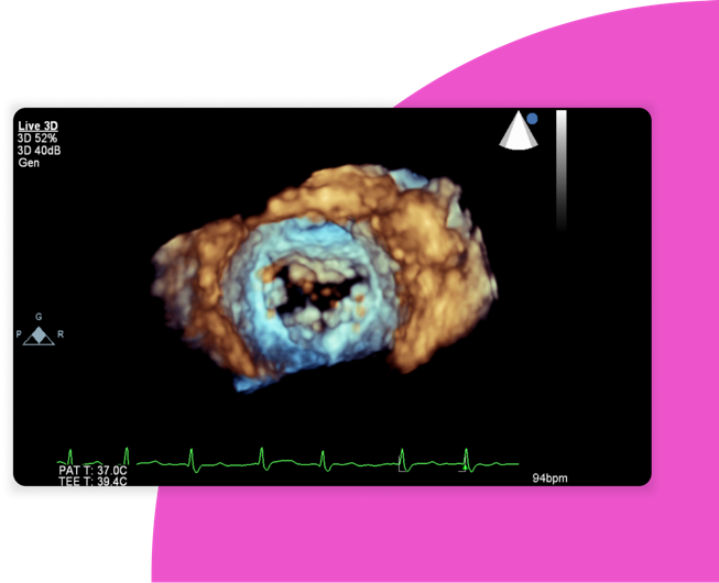 Cardiology Solutions | Merative
