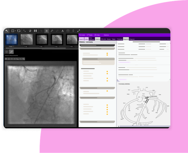 Cardiology Solutions | Merative