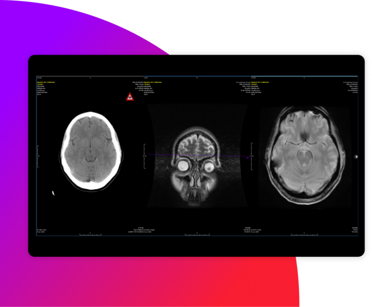Enterprise PACS System| Merative