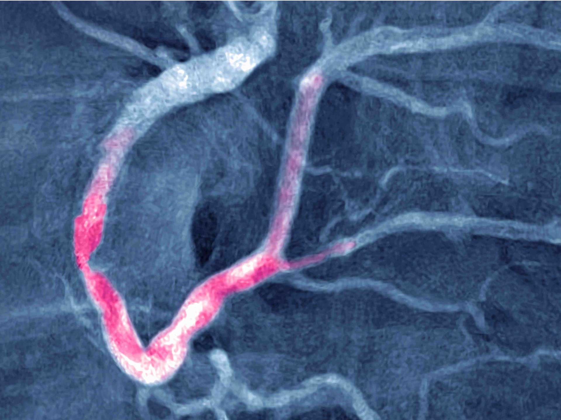 Medical Imaging Solutions and Software | Merative