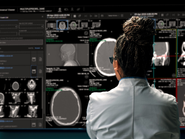 Merge Universal Viewer