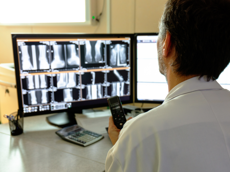 Merge Vendor Neutral Archive